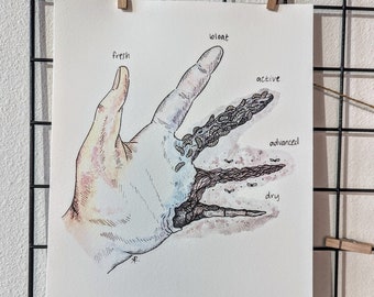 Stages of Decay Hand Art Board Print by Skye Rain Art Forensic Science ...