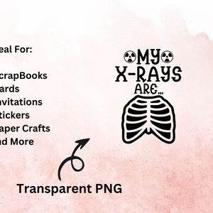 My X-rays Are Radiology Svg Png, X Ray Svg Files, Radiology Tech Svg ...