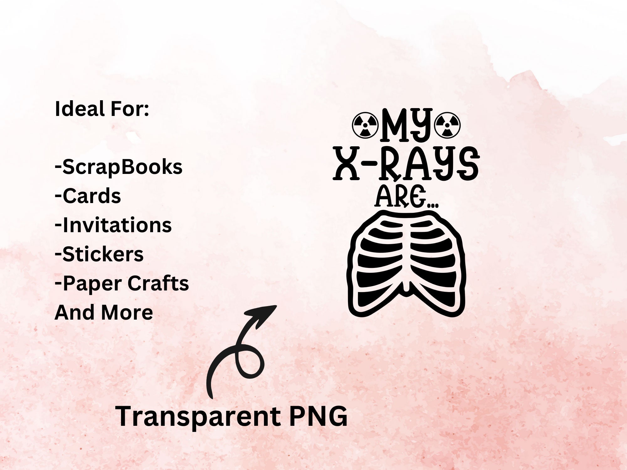 My X-rays Are Radiology Svg Png, X Ray Svg Files, Radiology Tech Svg ...