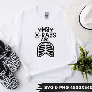 My X-rays Are Radiology Svg Png, X Ray Svg Files, Radiology Tech Svg ...