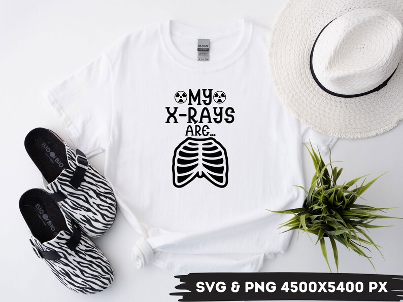 My X-rays Are Radiology Svg Png, X Ray Svg Files, Radiology Tech Svg ...