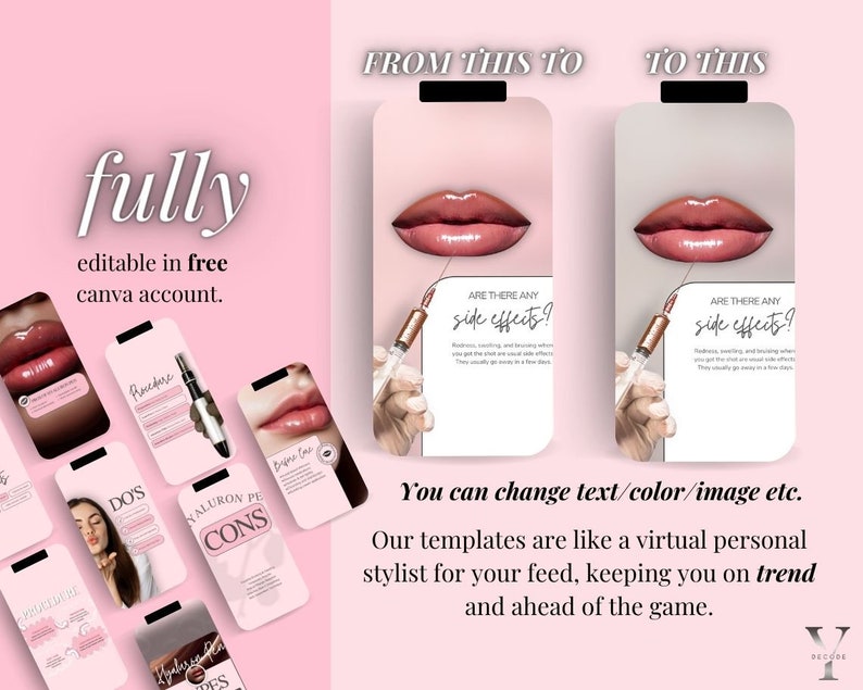 Lip Filler Template Hyaluron Pen Instagram Lip Filler Post Esthetician ...