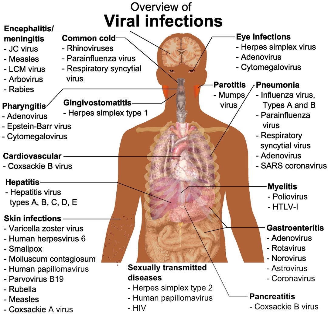 25x24in Poster Simplistic Overview of the Main Viral Infections and the ...