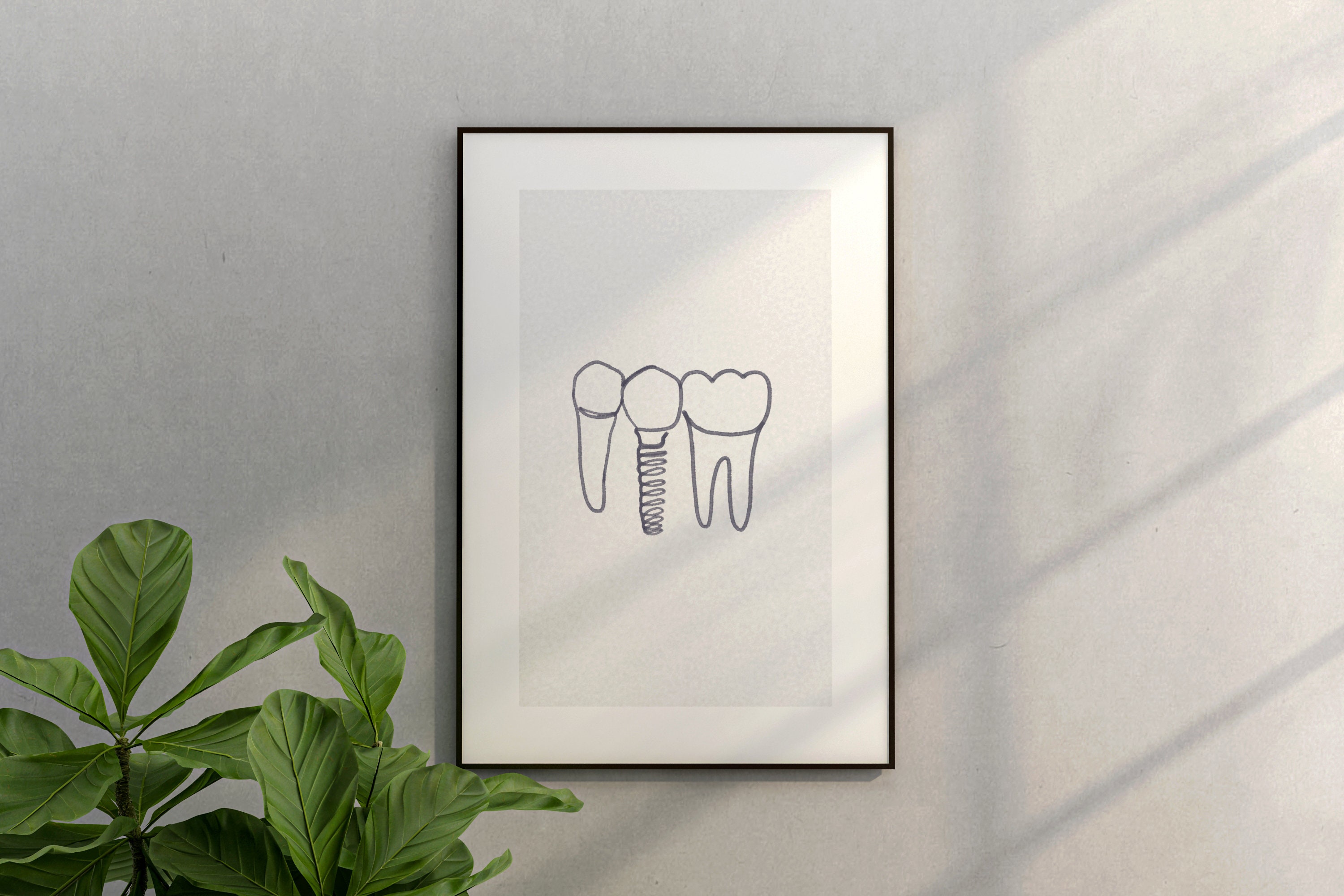 Minimalist Dental Wall Art, Abstract Dental Line Drawing, Printable ...