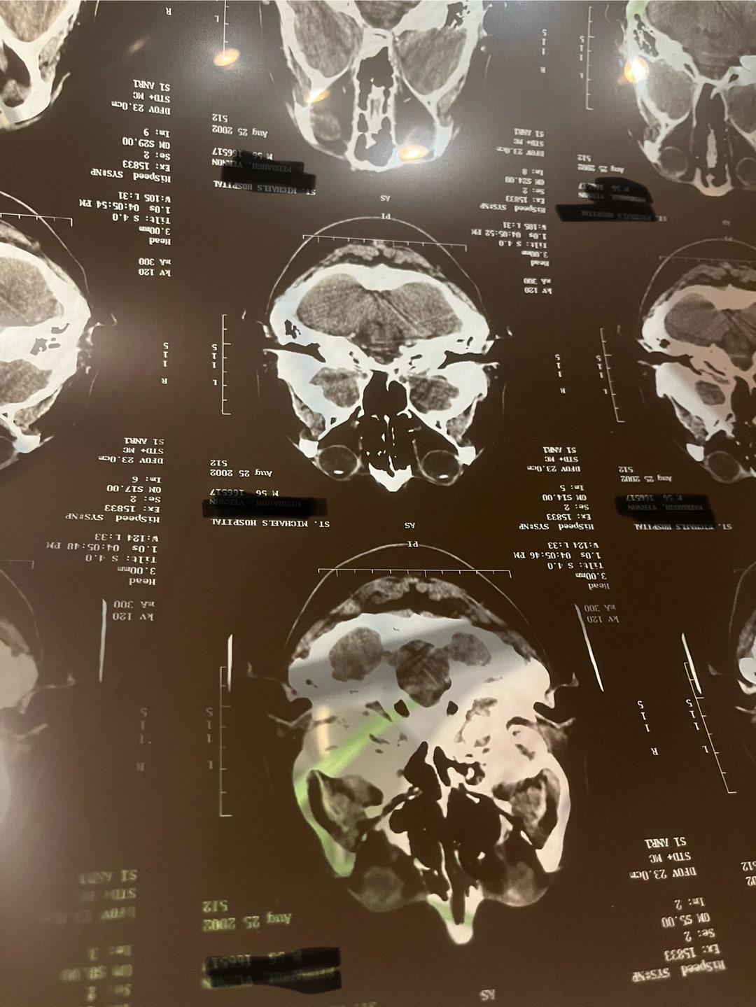 Brain MRI Film - Etsy