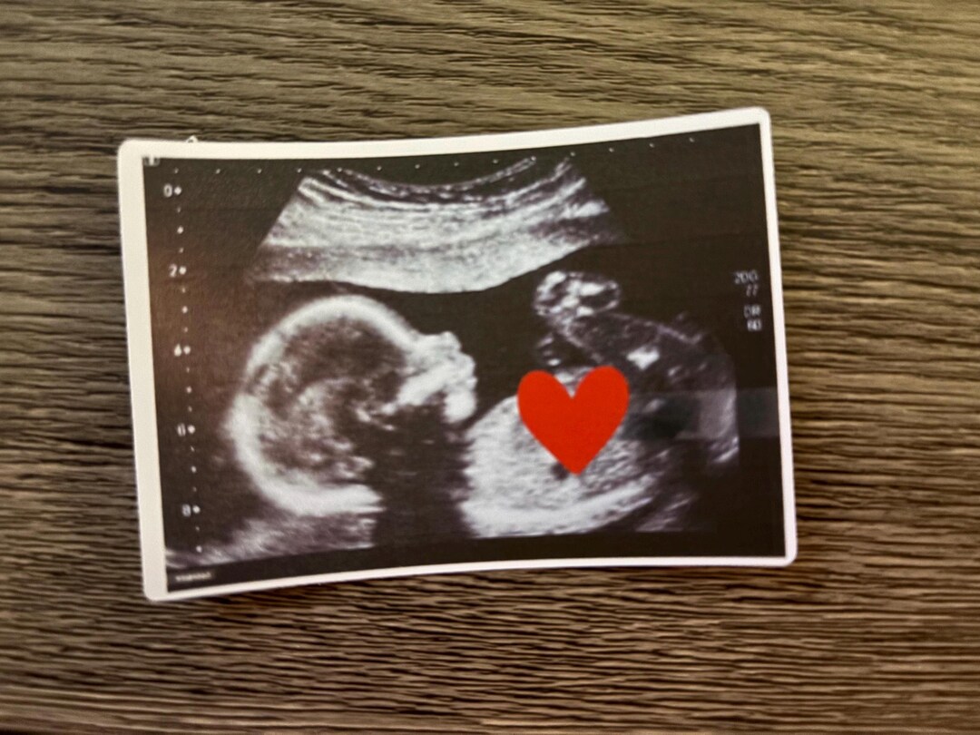 Custom Ultrasound Sticker - Etsy