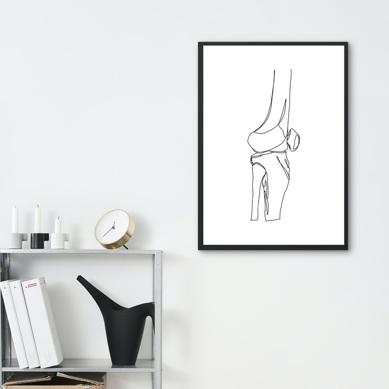 Knee Anatomy Printable Poster Physiotherapy Office Poster - Etsy