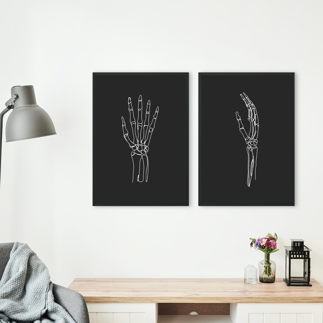 Hand Therapy Poster Anatomy Line Art, Occupational Therapy Hand Therapy ...