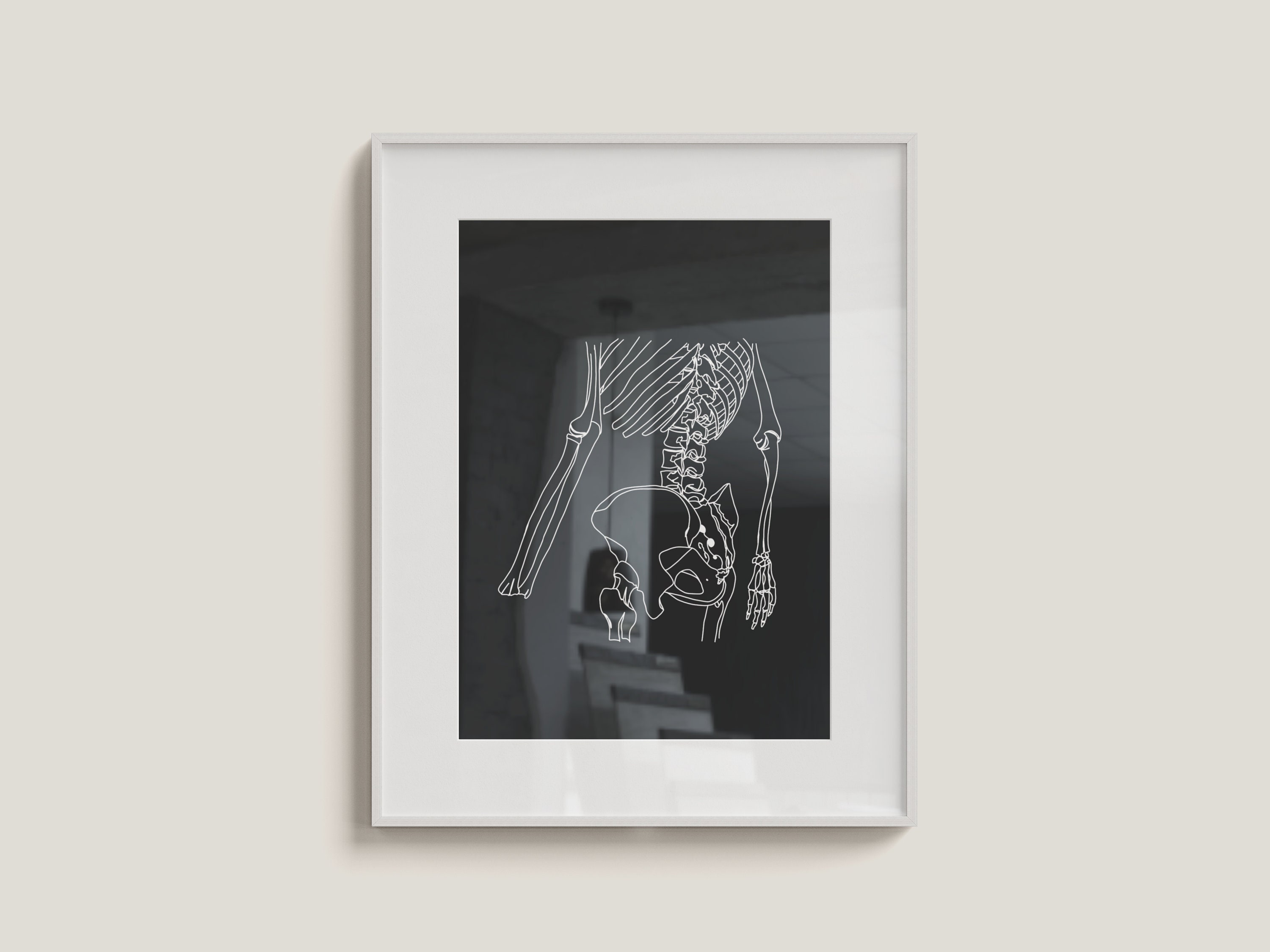 Anatomy Pelvic and Spinal Poster Bundle, 12 Posters, Physiotherapy ...