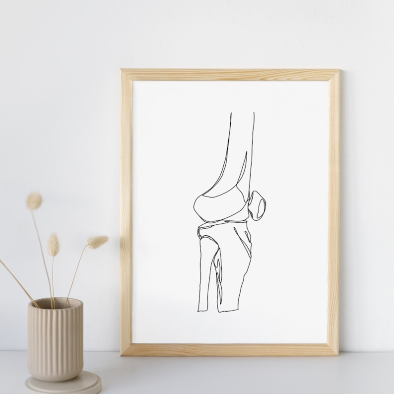 Knee Anatomy Printable Poster, Physiotherapy Office Poster ...