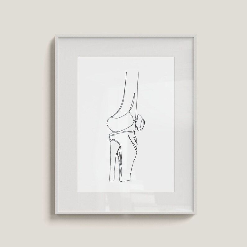 Knee Anatomy Printable Poster, Physiotherapy Office Poster ...