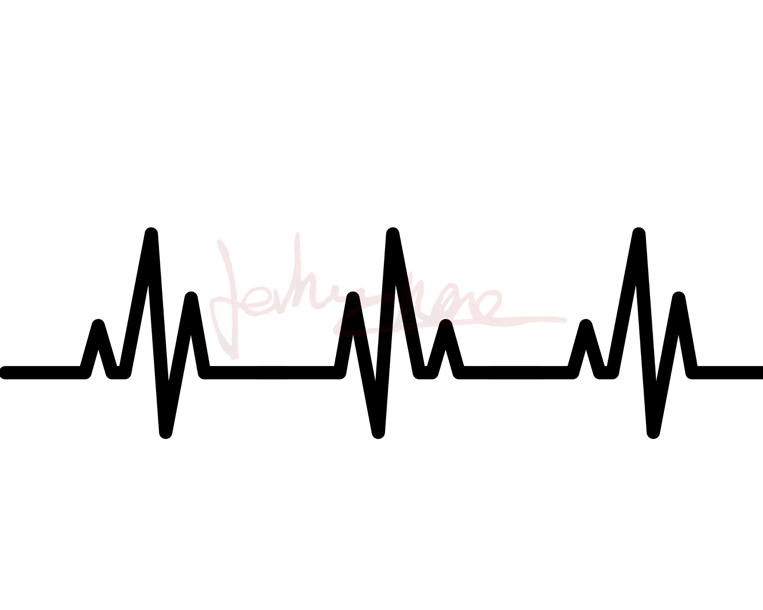 Heartbeat Png, Heartbeat Clipart, Cardiogram, Lifeline, ECG, EKG ...