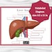 Liver Anatomy Diagram – Printable Educational Resource (instant ...