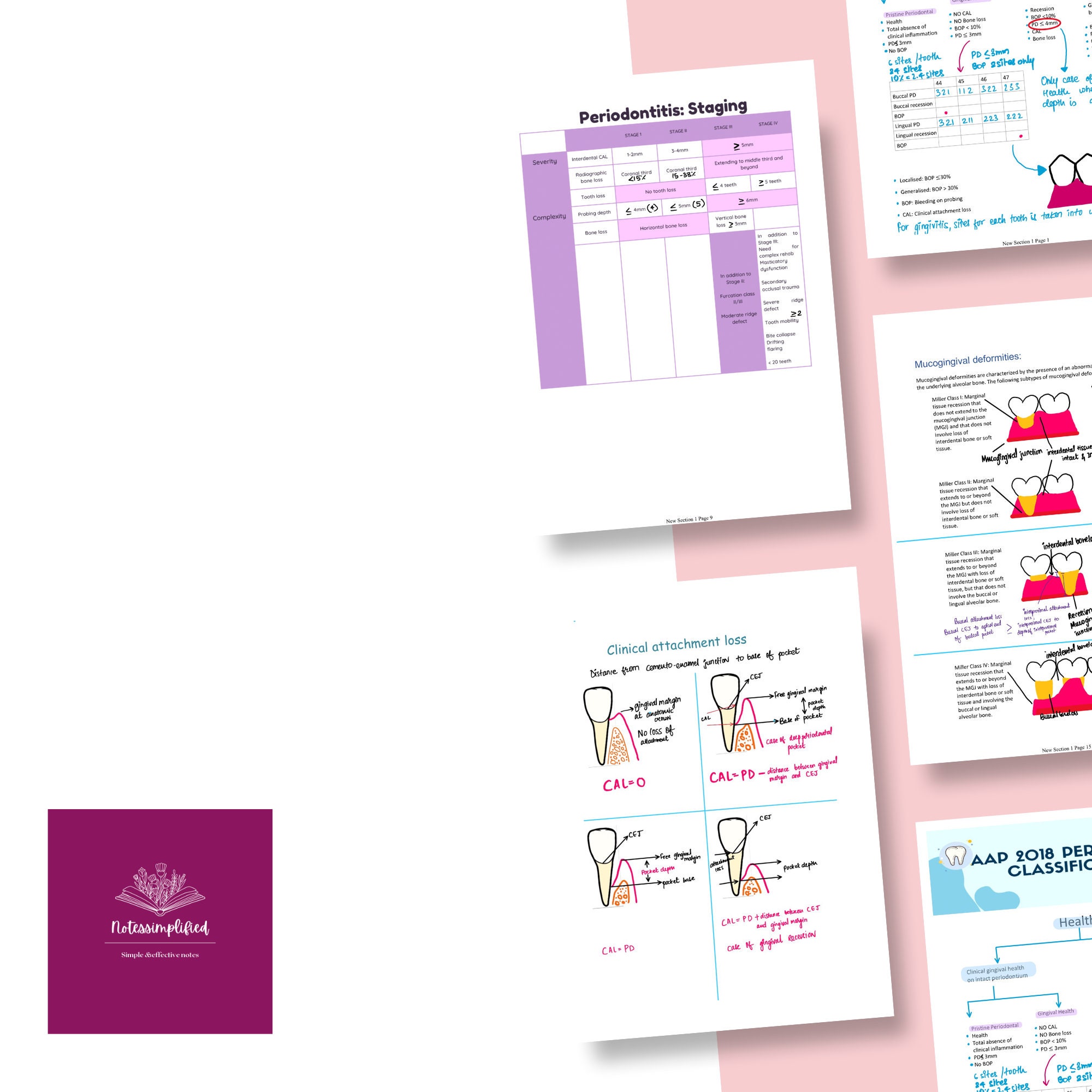 Periodontal Classification New Periodontal Classification Dental Notes ...