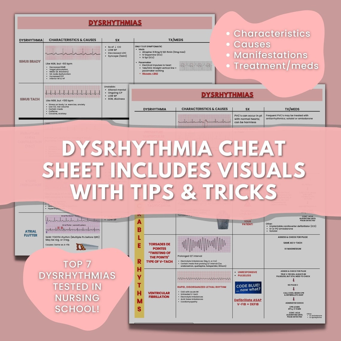 EKG Dysrhythmia Cheat Sheet Bundle: Nursing School Study Guide (digital ...