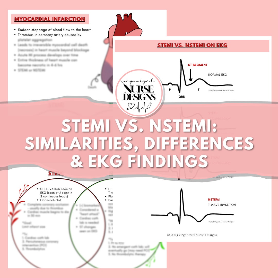 Cardiac Nursing School Study Guide STEMI Vs. NSTEMI | Nursing School ...