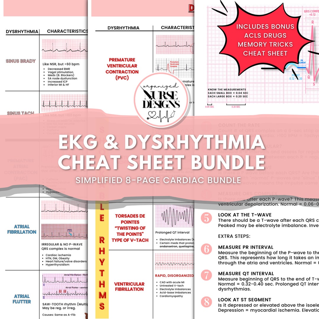 EKG Dysrhythmia Cheat Sheet Bundle: Nursing School Study Guide (digital ...