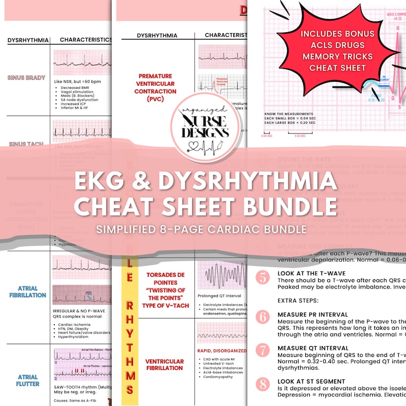 EKG Dysrhythmia Cheat Sheet Bundle: Nursing School Study Guide (digital ...