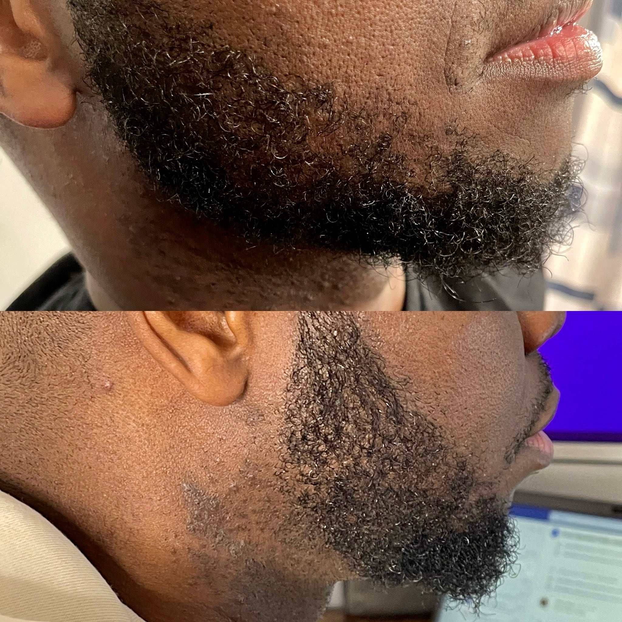 Patchy Beard Growth Oil Thicken And Fill In Uneven Areas Naturally Etsy