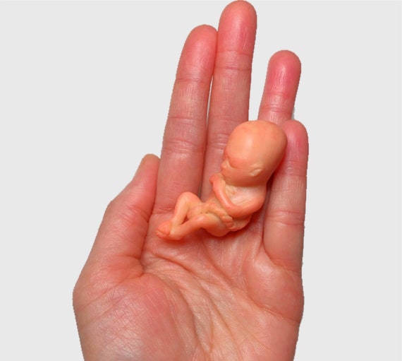 12 Week Miscarried Fetus 14 Week Miscarriage Fetus | TikTok