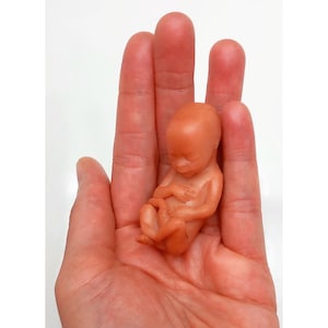 MADE TO ORDER 13 Week Gestation Fetus, Stage of Fetal Development ...