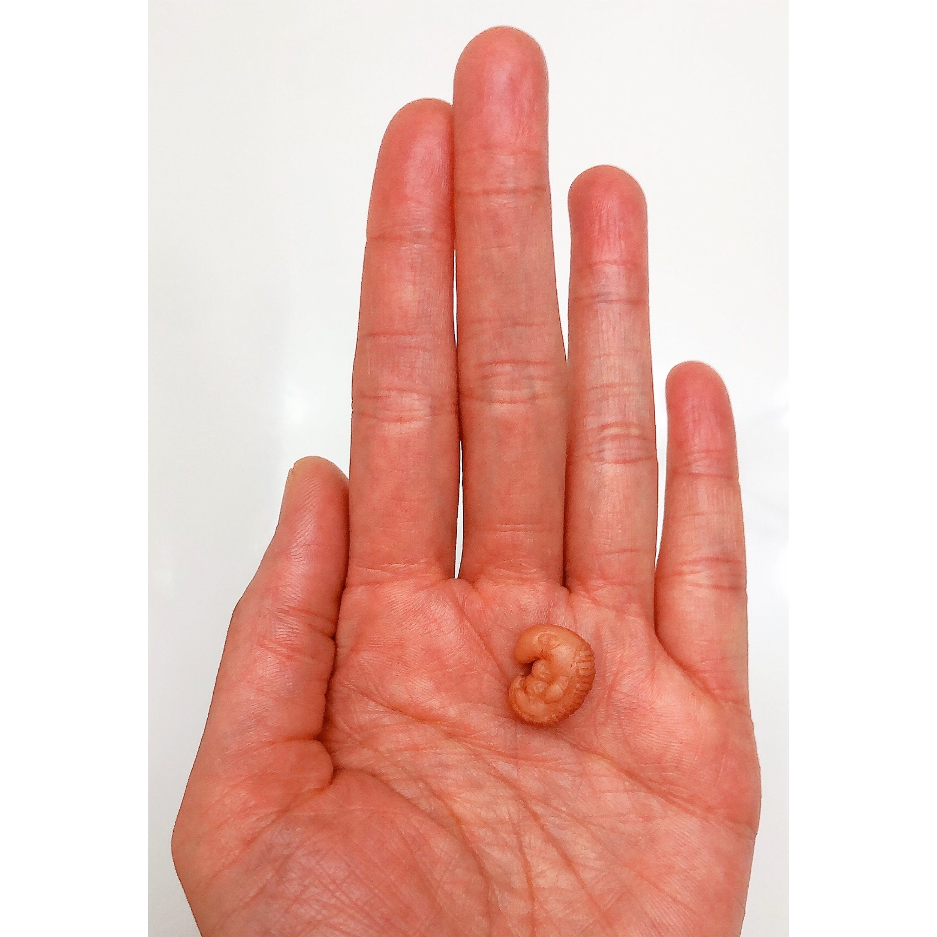 Actual Pictures Fetal Development