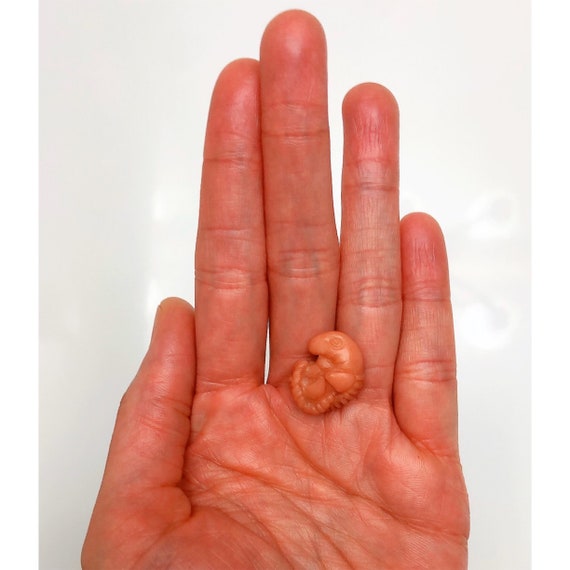 5 Week Embryo Miscarriage 5 Weeks And 7 Days Pregnant Baby Fetal