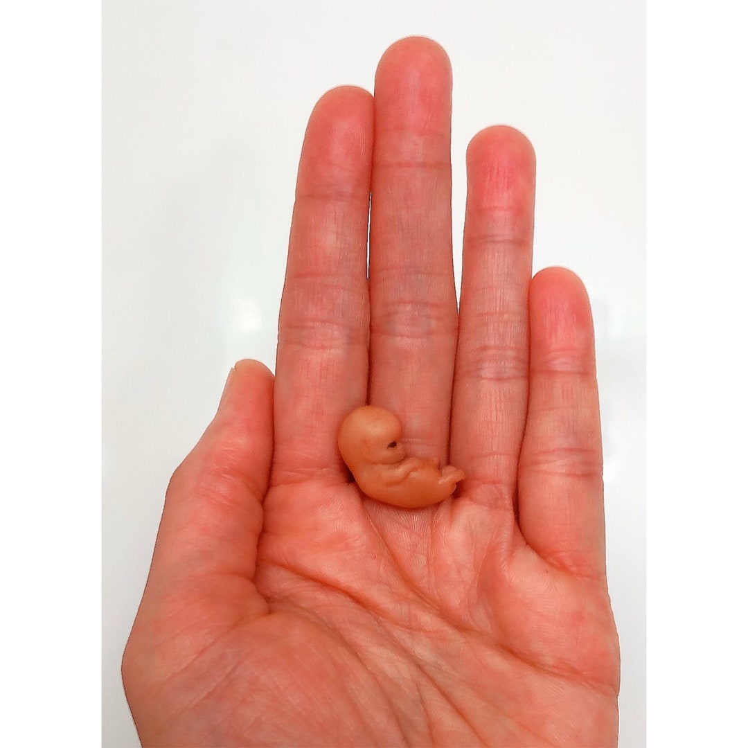 MADE TO ORDER 9 Week Gestation Embryo, Stage of Fetal Development ...
