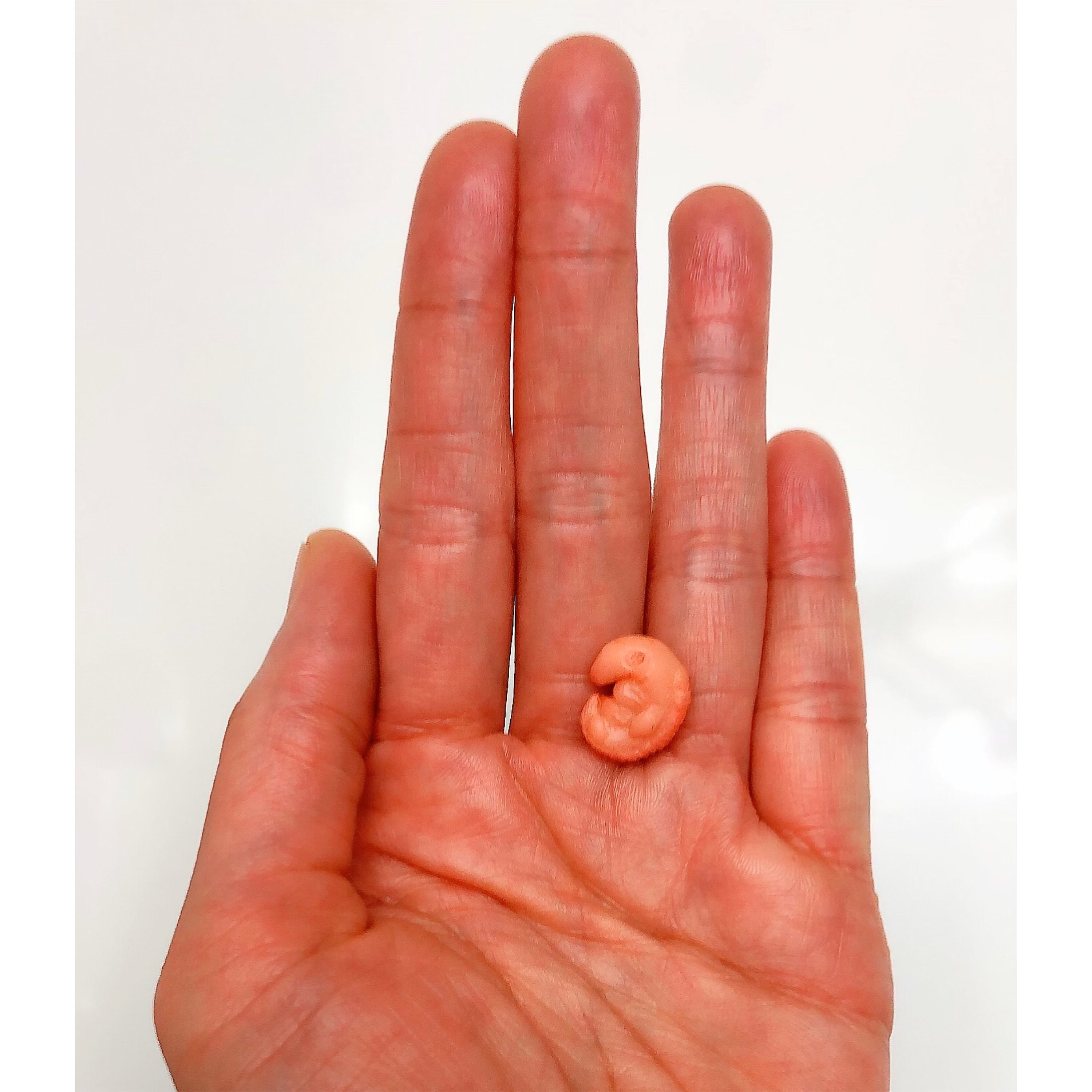 Week Embryo Miscarriage