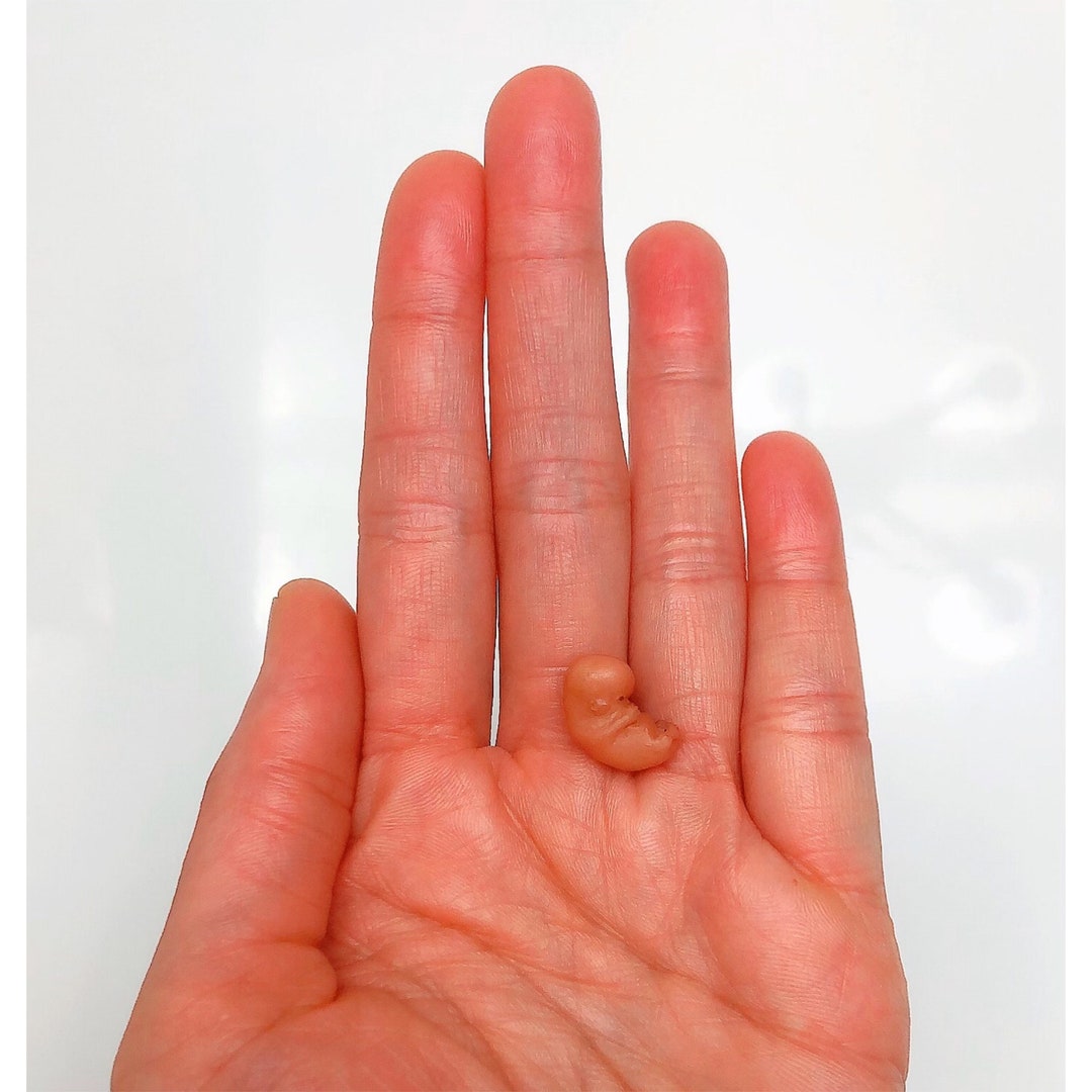 MADE TO ORDER 7 Week Gestation Embryo, Stage of Fetal Development ...