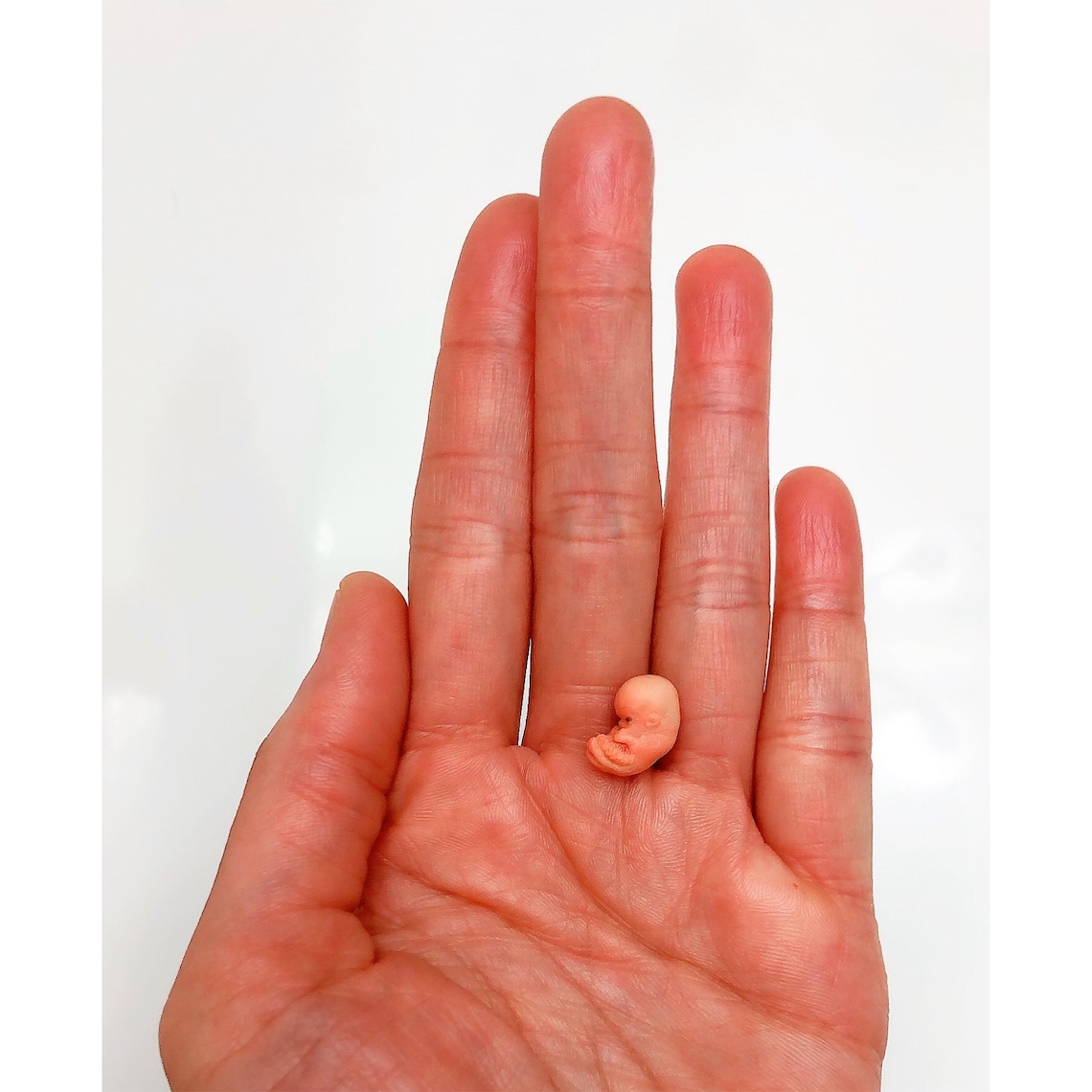 MADE TO ORDER 7 Week Gestation Embryo, Stage of Fetal Development ...