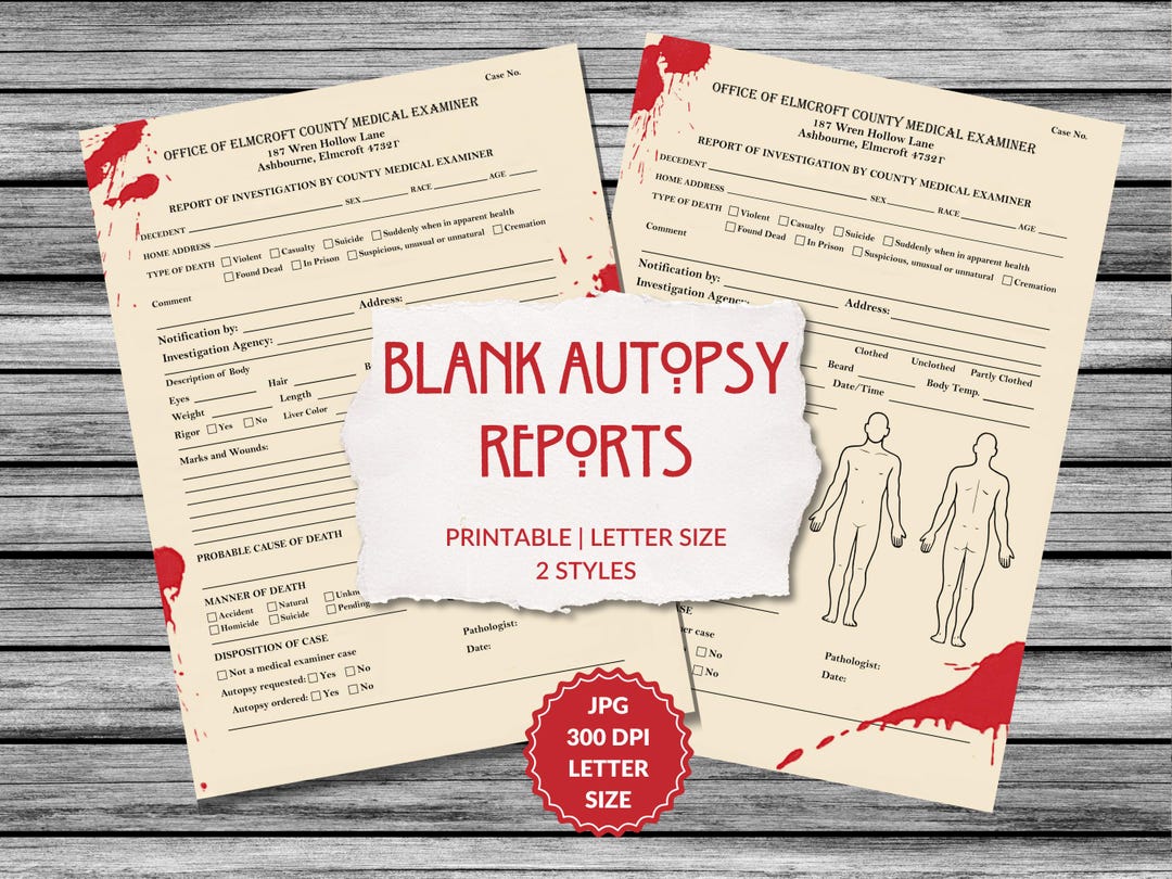 Autopsy Report Printable, Autopsy Report Template, Murder Mystery Game ...