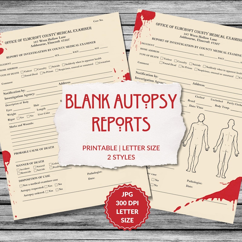 Evidence Board - Etsy