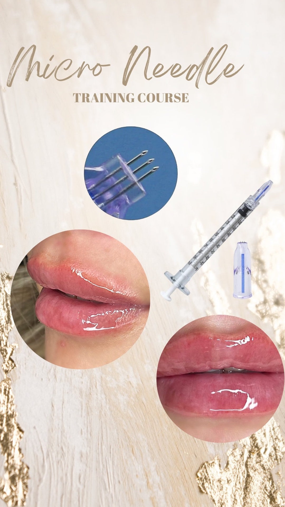 Micro Needle Lip Training - Etsy