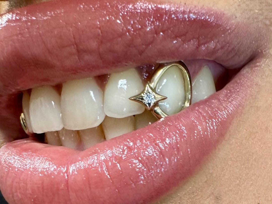 VVS Diamond Star Window Tooth Cap Grillz! FREE Worldwide Shipping! - Etsy