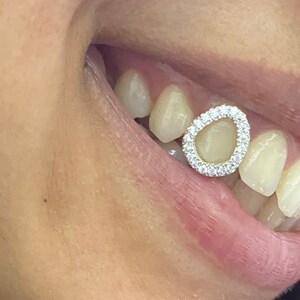 Iced Out Diamond Window Tooth Cap Grillz UK Worldwide Shipping! - Etsy