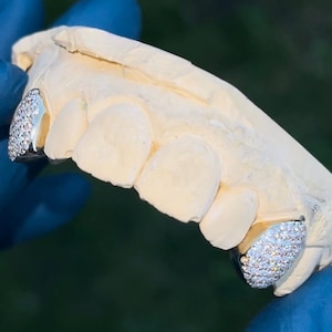 VVS Moissanite Tooth Cap Grillz, Diamond Teeth Worldwide Shipping! - Etsy