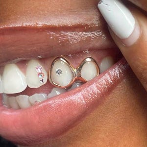 Double Window Tooth Grillz: Custom Gold/silver Caps - Etsy