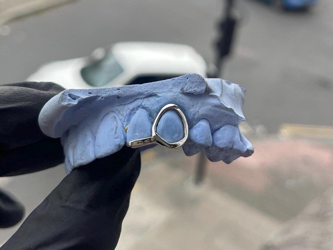 Window With Tip Grillz Silver/gold Tooth Cap - Etsy