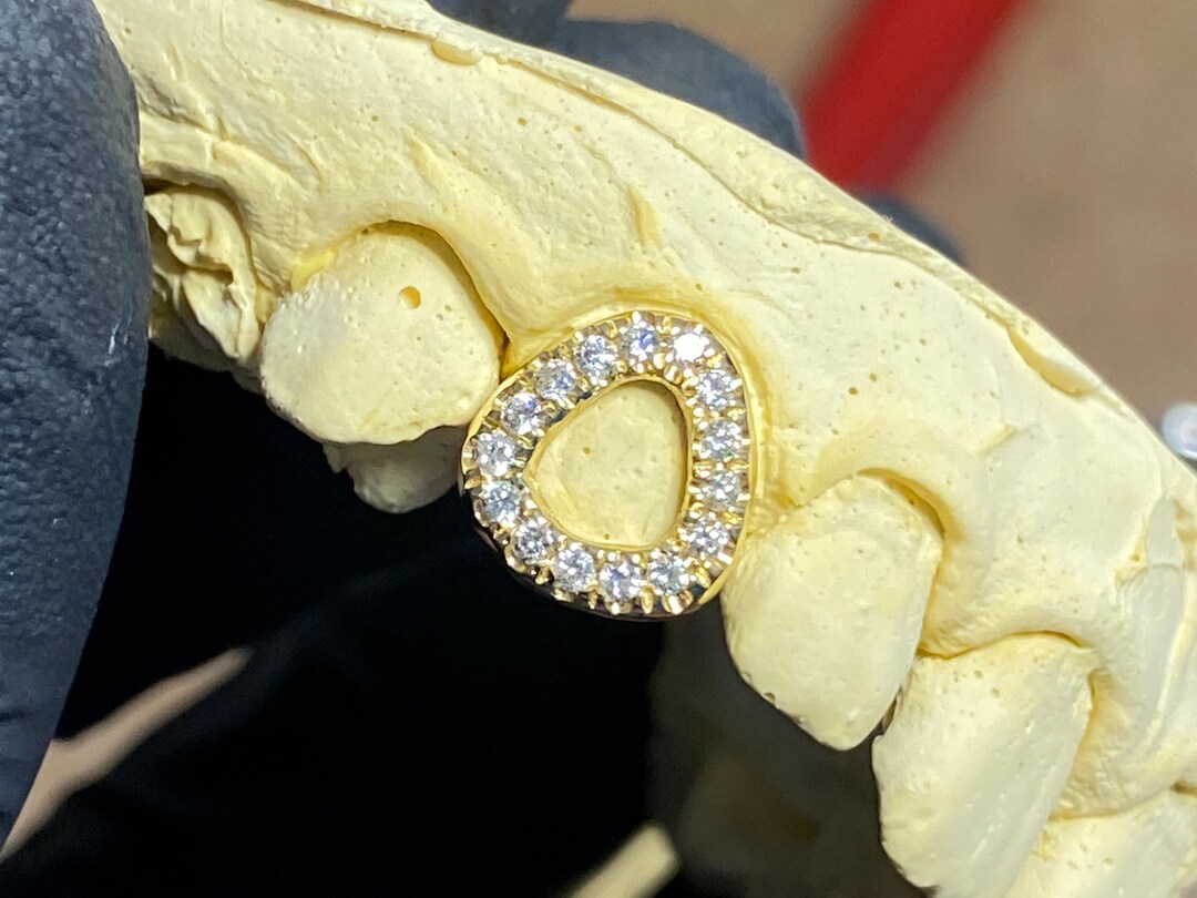 Iced Out Diamond Window Tooth Cap Grillz UK Worldwide Shipping - Etsy