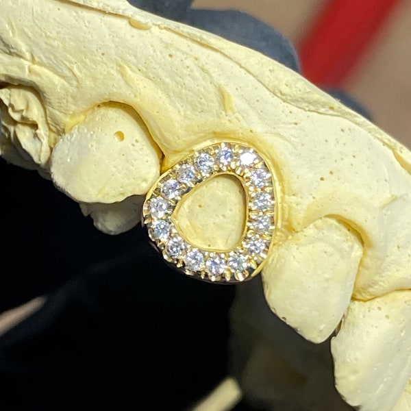 Tooth Cap Diamonds - Etsy