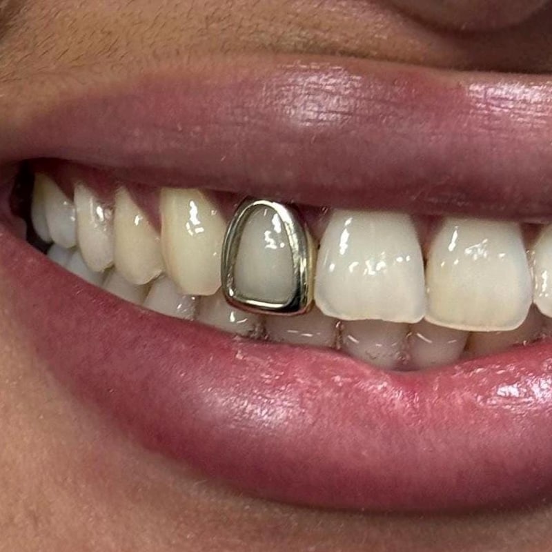 Custom Gold Grillz Open - Etsy UK