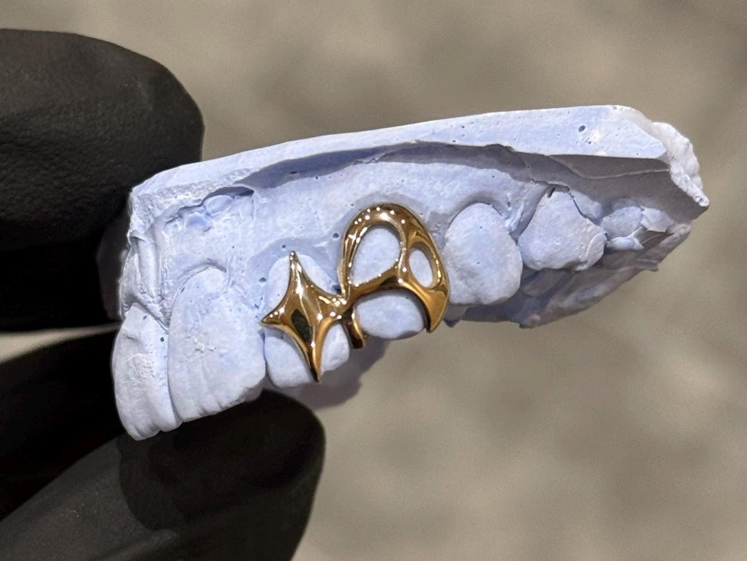 Custom Star Grillz: Abstract Gold or Silver Teeth Jewelry - Etsy
