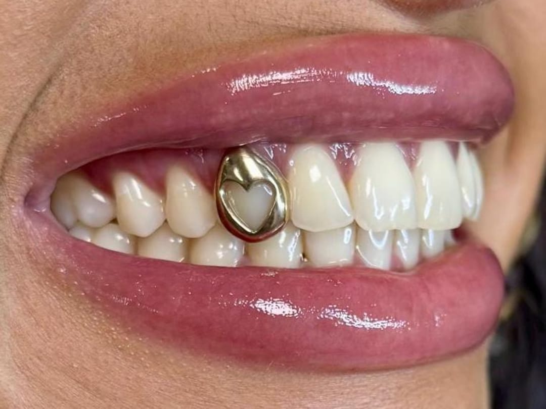 Classic Heart Window Tooth Cap! Custom Grillz, FREE Shipping! - Etsy
