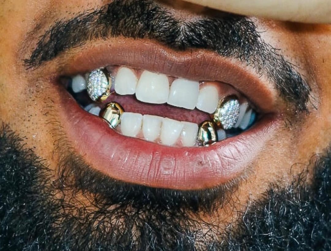 VVS Moissanite Tooth Cap Grillz, Diamond Teeth Worldwide Shipping! - Etsy