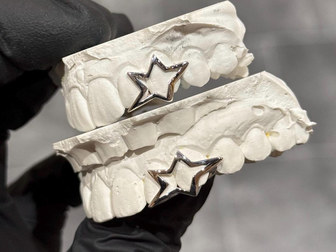Abstract Star Grillz! Silver, Gold Teeth FREE Shipping! - Etsy Canada