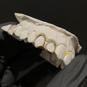 Double Window Tooth Grillz: Custom Gold/silver Caps - Etsy