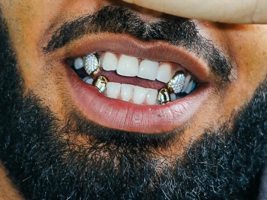 VVS Moissanite Tooth Cap Grillz, Diamond Teeth Worldwide Shipping - Etsy