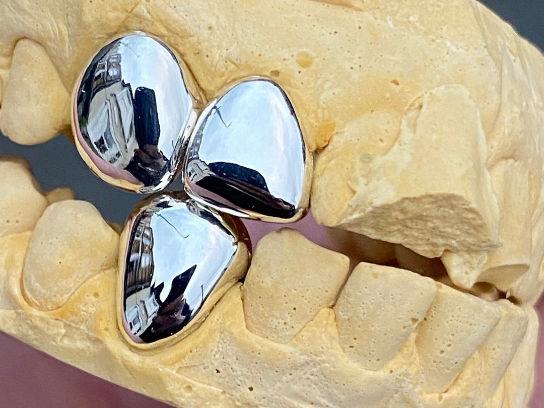 2x Sterling Silver 925 Grillz Any Teeth UK - Etsy