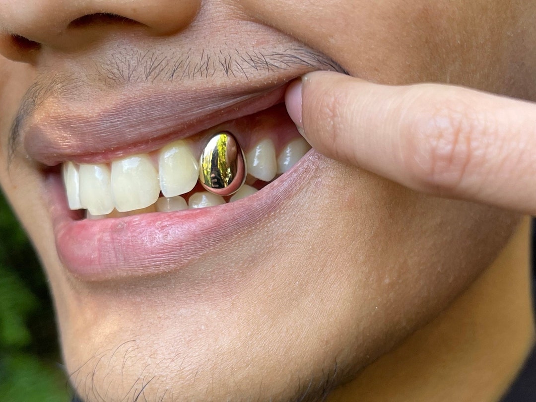 Solid Dental Yellow Gold Custom Fit Tooth Cap Real Grill Grillz - Etsy